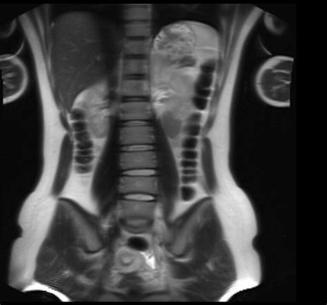 Mri Localizer Scout Or Survey Scan T1t2 And 3d Localizers