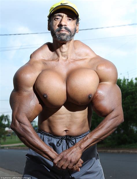 Synthol Injections