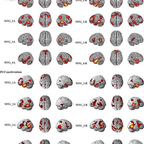 Overlapped Connectivity Between Resting‐state Functional Connectivity