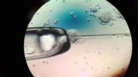 Blastocyst Injection Youtube