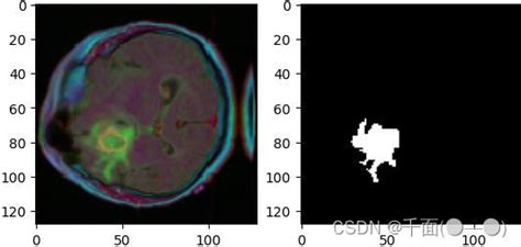 albumentations 医学图像数据增强方式 医学图像的数据增强csdn csdn博客