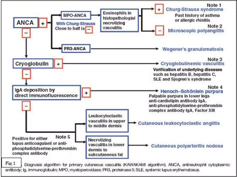 Vasculitis An Approach Pptx