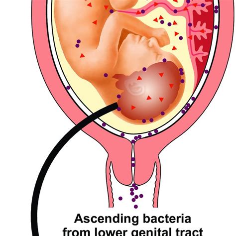Cdc And Acog Recommendations For Routine Testing Screening And Download Table
