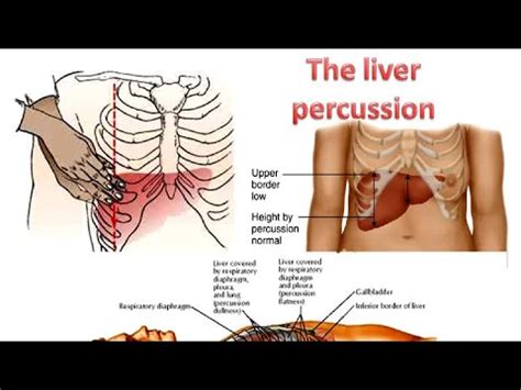 3 Percussion Palpation Of Liver And Spleen Youtube