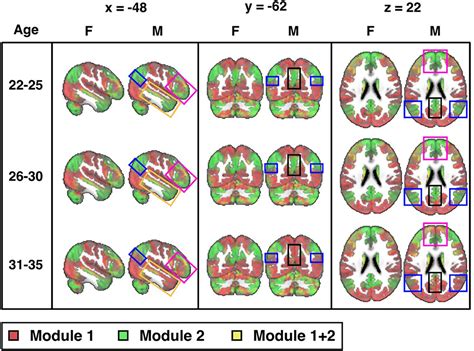 Frontiers From Default Mode Network To The Basal Configuration Sex