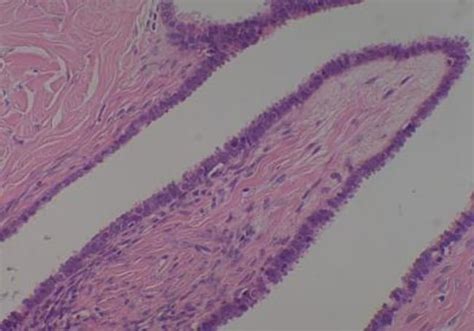 Novus Biologicals™ Human Ovary Tissue Microarray Cancer Slide Human Ovary Tissue Microarray