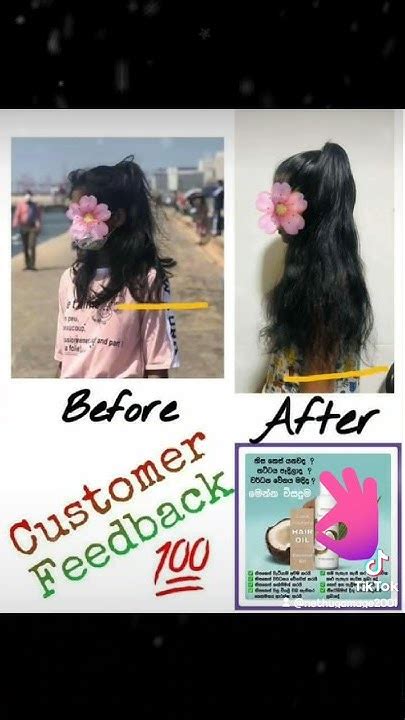 ඔබේ හිසකෙස් නිසා ඔබ පීඩා විදිනවාද මෙන්න ඔබට සාර්ථක ප්‍රතිකාරයක් Youtube