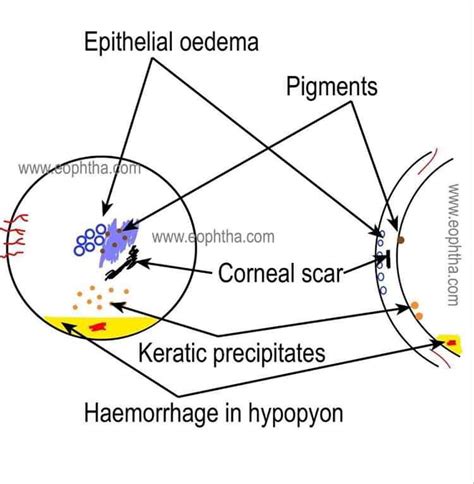 Color Coding In Ophthalmology Notes And Synopses Facebook