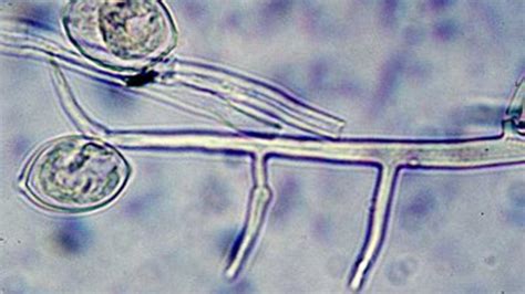 Plant Pathogen East Bay Parks
