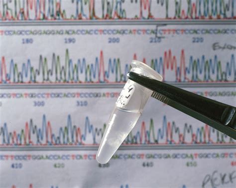 Dna 염기 서열 분석 가격은 20 년 만에 27 억 달러에서 300 달러로 떨어졌습니다