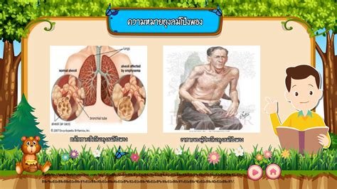 สื่อการสอนเรื่อง โรคถุงลมโป่งพอง Kittirat Norkhud 633263005 หน้าหนังสือ 3 พลิก Pdf ออนไลน์