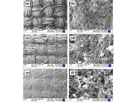 Vp Sem Morphology At 100Â And 10 Kx Magnification Taken Of The Download Scientific Diagram