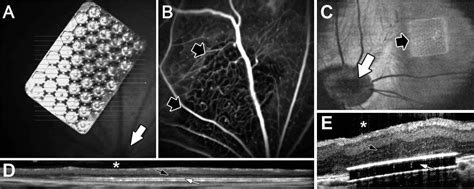 Figure 2 From Integration Of Perforated Subretinal Prostheses With