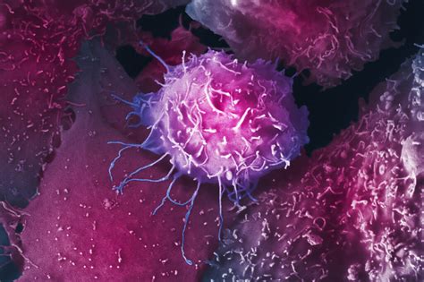 Sync T Shows “highly Encouraging” Activity In Prostate Cancer Cancer