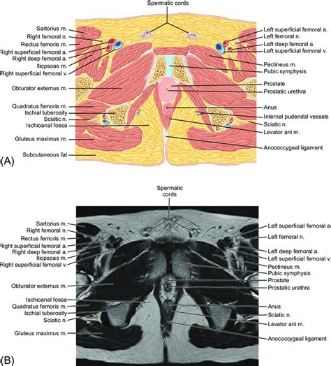 A B The Normal Male Anatomy Of The Perineum At The Level Of The Mid