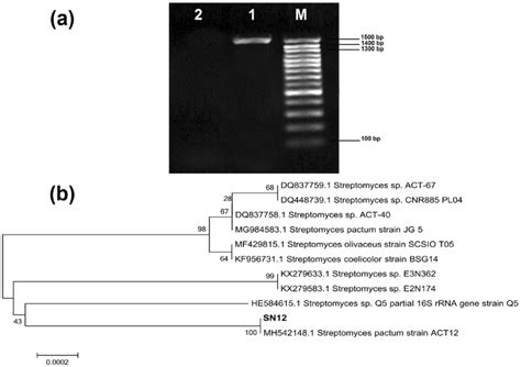 A Electrophoresis Of Pcr Product Column M Marker 1500bp 1 Isolate