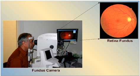 Figure 1 From Retinal Vessels Segmentation Techniques And Algorithms A