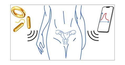 Vaginal Sensors ACS Sensors