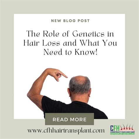 The Role Of Genetics In Hair Loss What You Need To Know
