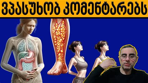 ვპასუხობ კომენტარებს ვენური უკმარისობა ყბის სახსარი წონაში კლება და სხვა Youtube