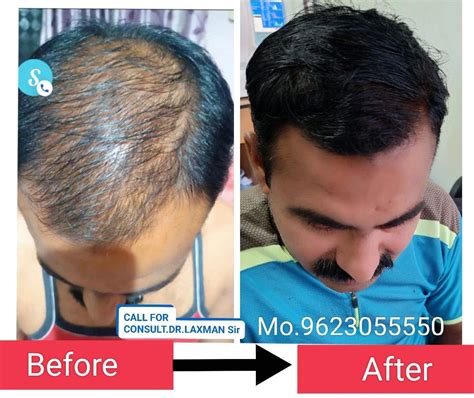 Drlaxman Rathod Posted On Linkedin