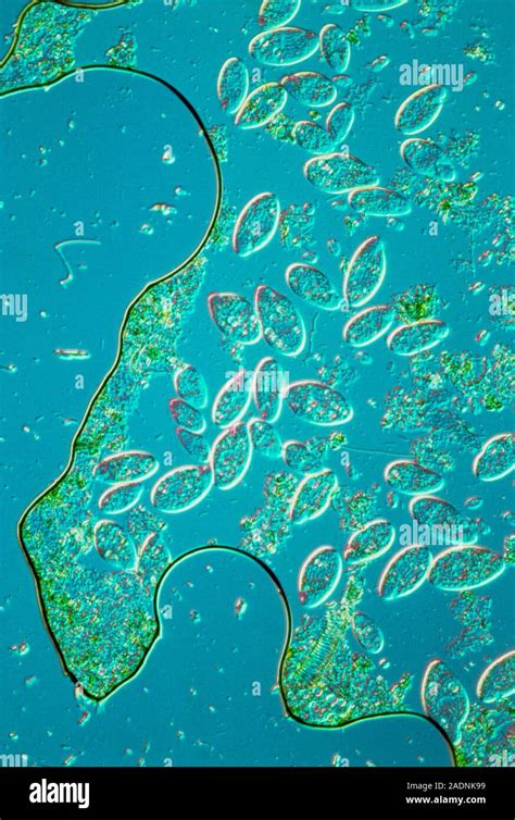 Light Micrograph Of A Group Of Ciliate Protozoans Colpidium Sp