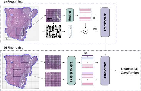 Figure 1 From Vision Transformer Based Deep Learning For Histologic