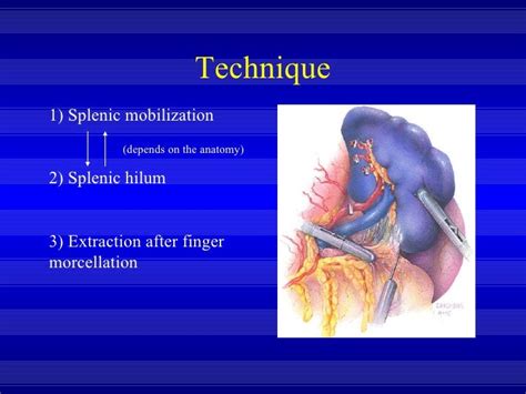 Laparoscopic Splenectomy