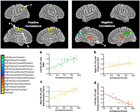 Intrinsic Functional Connectivity Ifc Correlations With Anhedonia Download Scientific Diagram
