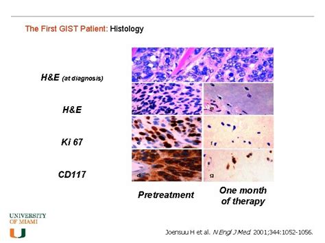 Overview Of Gist And Its Medical Management I