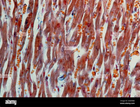 Light Micrograph Showing Bundles Of Muscle Fibres Of The Heart In A Longitudinal Section
