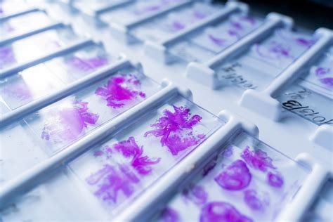 Full Lifecycle Software Development Of Ihc Slide Staining Instrument — Gener8 The Rnd Group