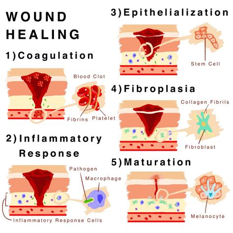 Cutaneous Wound Healing Process Transcriptional Signature Primes