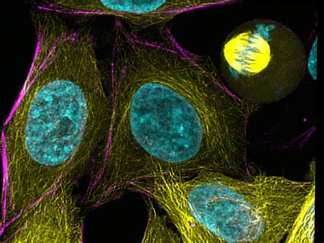 Oxford Instruments India On Linkedin Live Imaging Of Cell Division Mitosis