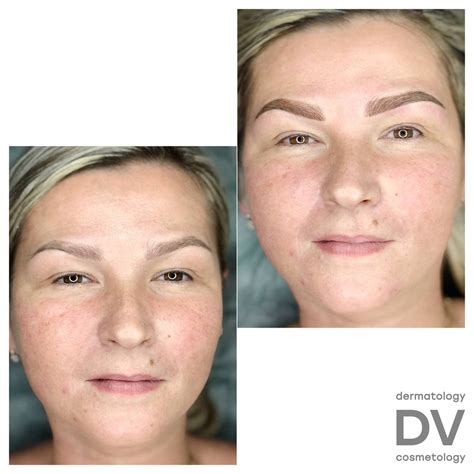 Перманентний макіяж татуаж брів і губ у Львові ДермаВіта