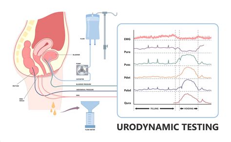 Urodynamic Study UDS VDS In Singapore AARE Urocare
