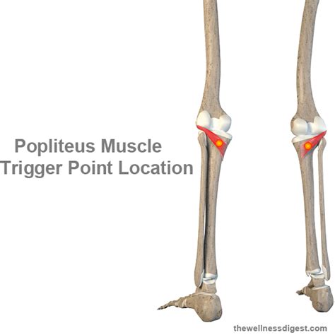 Popliteus Muscle Pain And Stiffness Behind The Knee The Wellness Digest