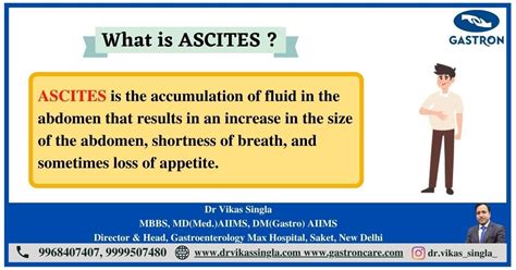 What Is Tips Procedure For Ascites At Indiana Townson Blog
