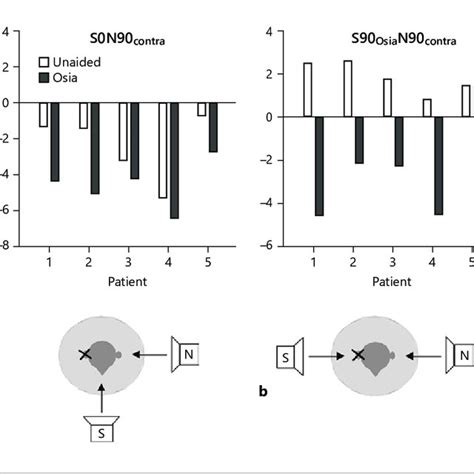 Osia Implant System And External Audio Processor Image By Cochlear