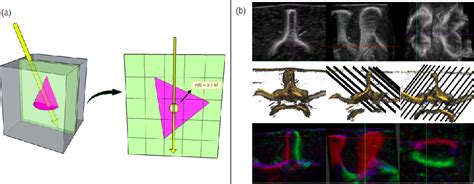 Figure 1 From Ultra Nerf Neural Radiance Fields For Ultrasound Imaging Semantic Scholar