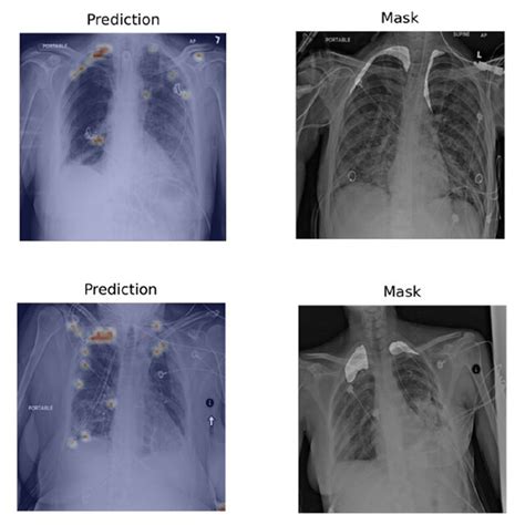 Examples Of Segmentation Visualization On The Testing Set The Download Scientific Diagram