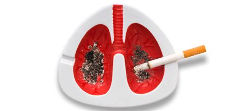 Рак легких | Meddoc