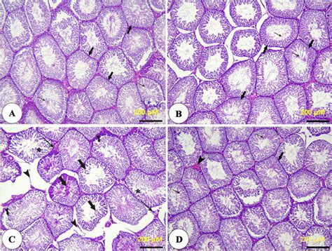 Representative Photomicrograph Of Testes Showing Normal Histological