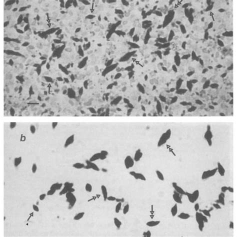 Pdf A Simple Method For Separation Of The Protein Crystal From