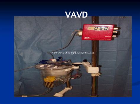 PPT CARDIO PULMONARY BYPASS PowerPoint Presentation Free Download ID