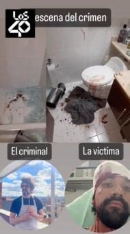 Comediante De F Ck News Sufri Terrible Accidente Y Lo Confirm Con Fotos Infobae