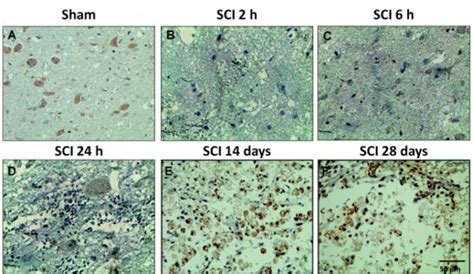 Analysis Of Gipr Expression In The Injury Epicenter Representative