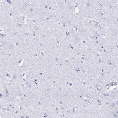 Runx3 Polyclonal Antibody Pa5 111475