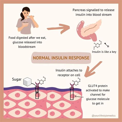 How To Reverse Insulin Resistance Naturally — Your Lifestyle Medics
