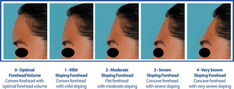 Dermatologic Surgery